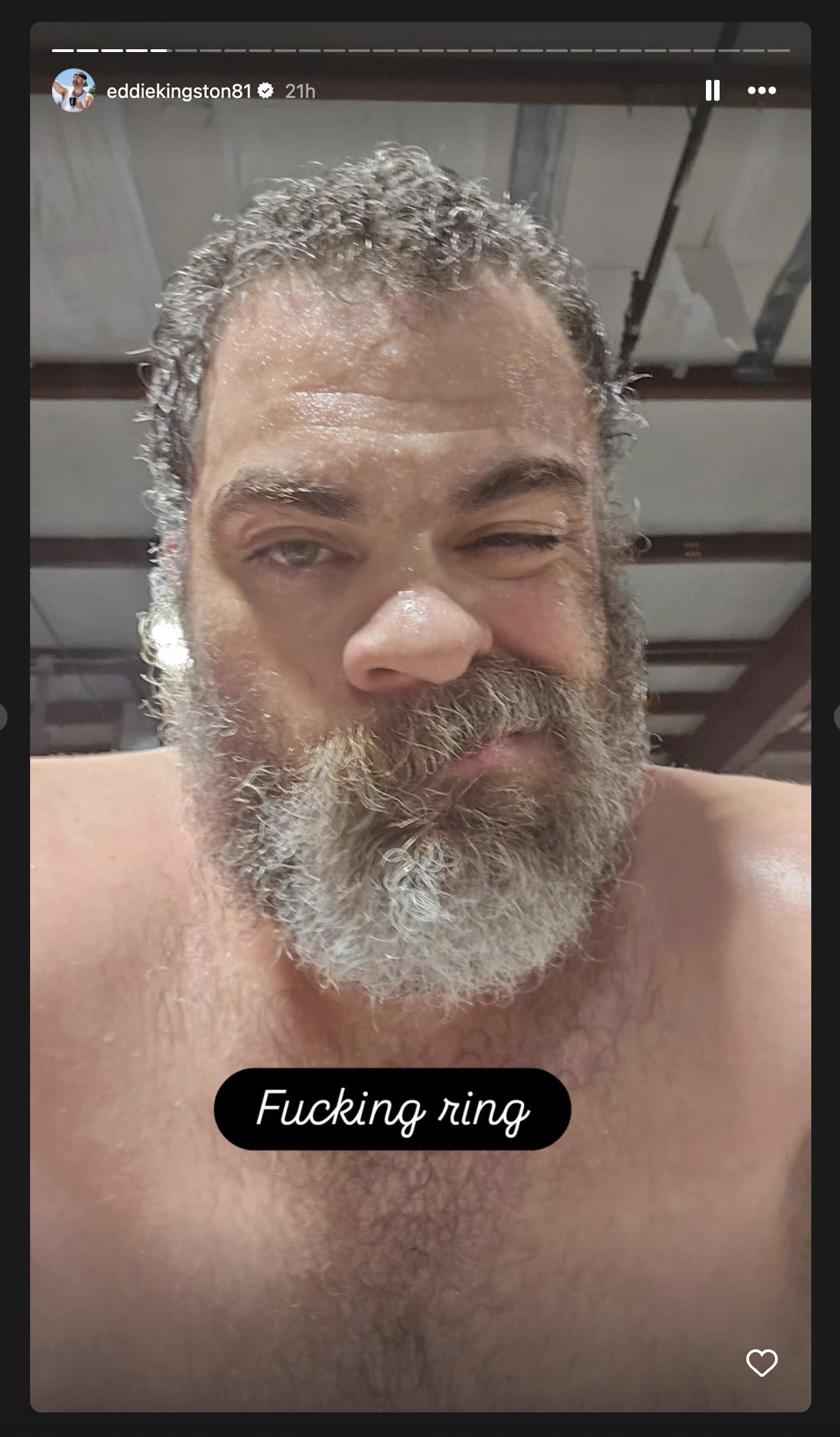Eddie Kingston Looks Almost Unrecognizable In Update On In-Ring Return